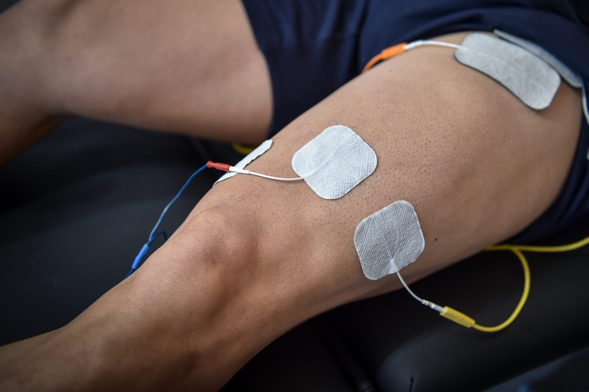 Electrical Stimulation Therapy